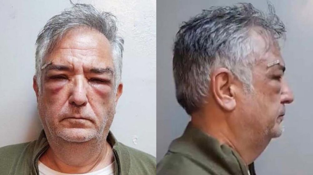 Causa Andis: renunció un funcionario de la Oficina Anticorrupción que ...